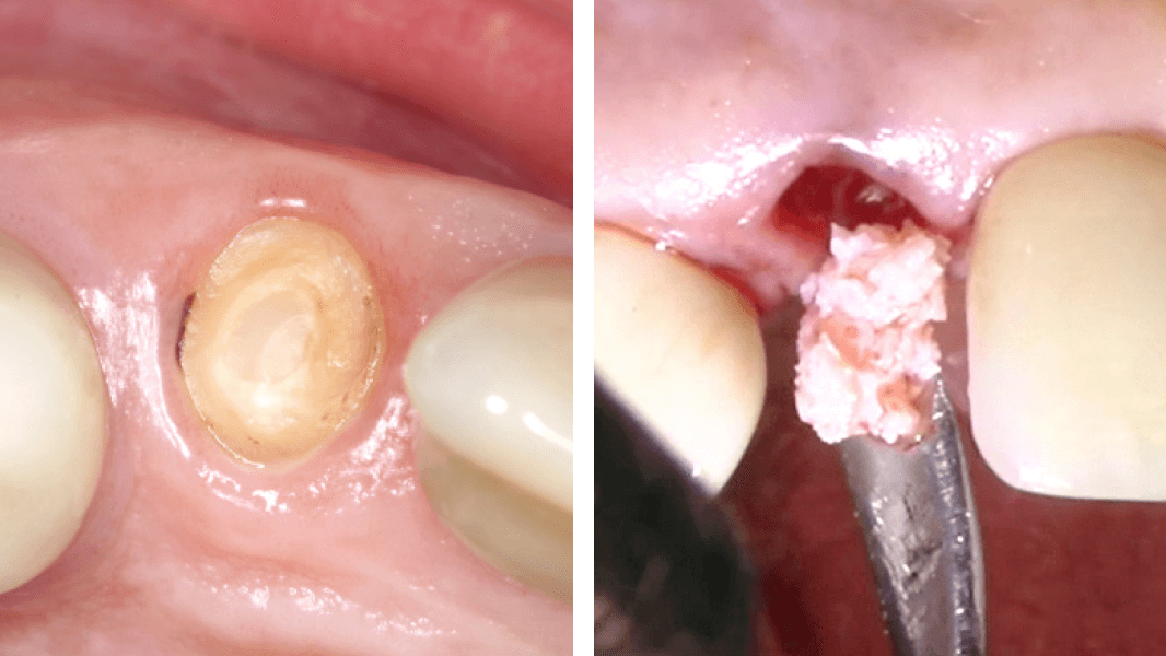 NovoMatrix™ | Camlog
