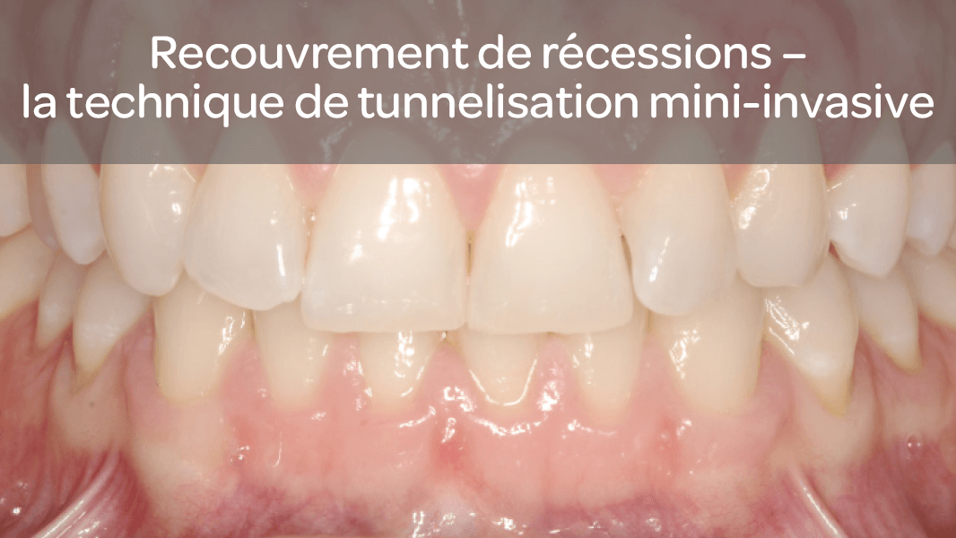 NovoMatrix® matrice tissulaire