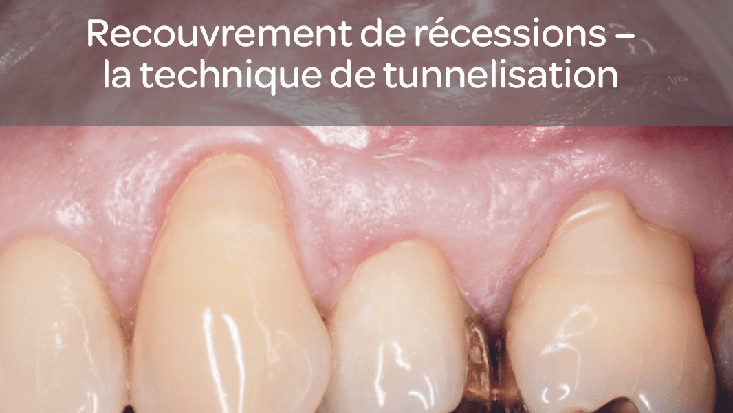 NovoMatrix® matrice tissulaire